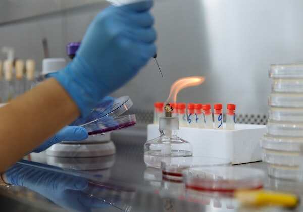 Melting and Boiling Points of Acetone: Key Facts and Influencing Factors