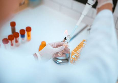 Melting and Boiling Points of Acetone: Key Facts and Influencing Factors