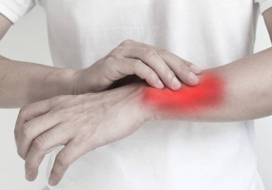 Calcium gluconate gel for hydrofluoric acid burns