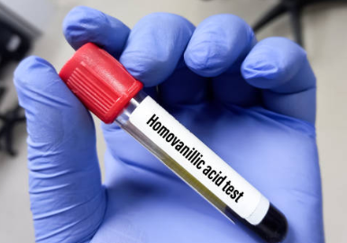 Homovanillic Acid: Properties, Medical & Laboratory Applications